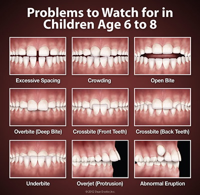 Early Orthodontic Treatment | Edney Orthodontics